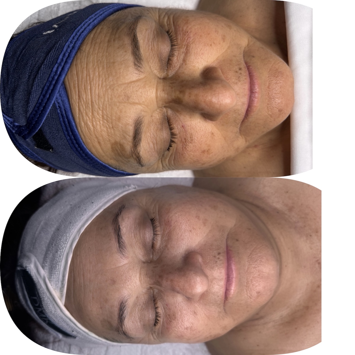 Custom Facials – The Esthetic Room